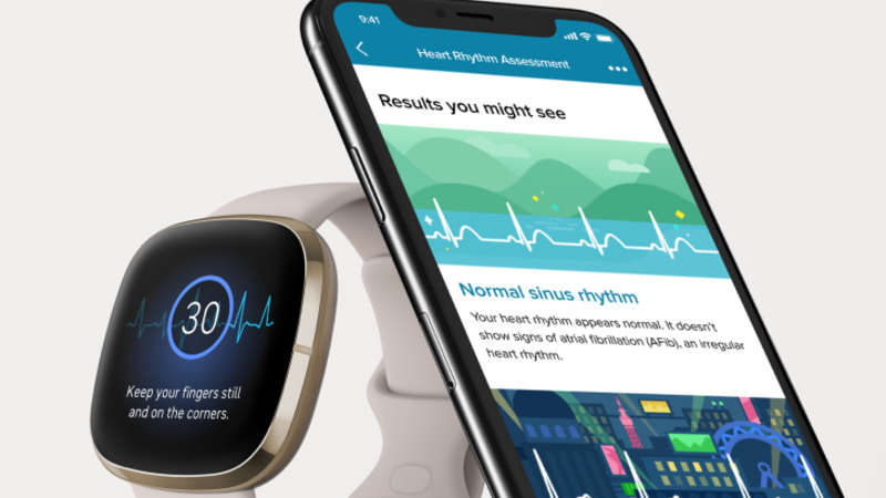 Fitbit | Buy Now Pay Later Stores